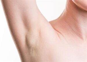 Ganglio inflamado con dolor en axila - Sujeto